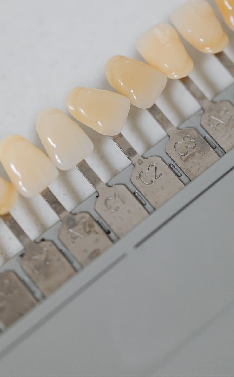 Tout savoir sur les résines composites en odontologie