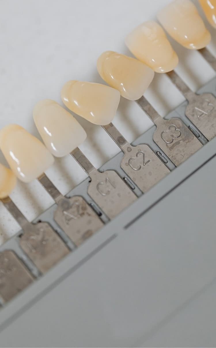 Sur-occlusion et sous-occlusion en odontologie